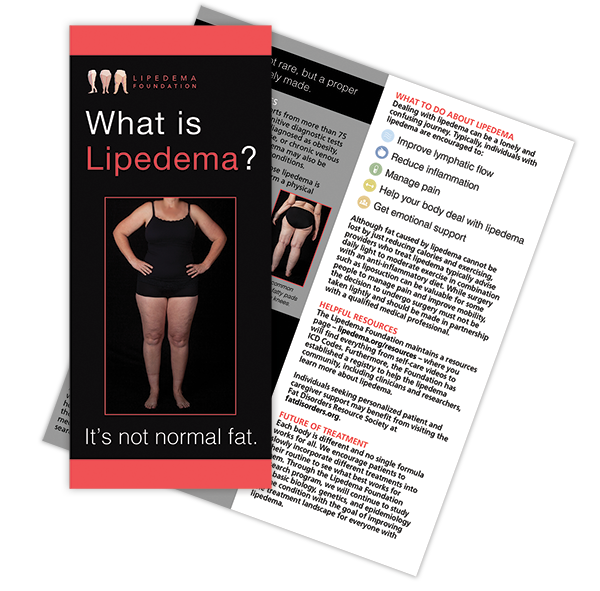 Lipedema Support for Patients and Caregivers – Lipedema Foundation ...