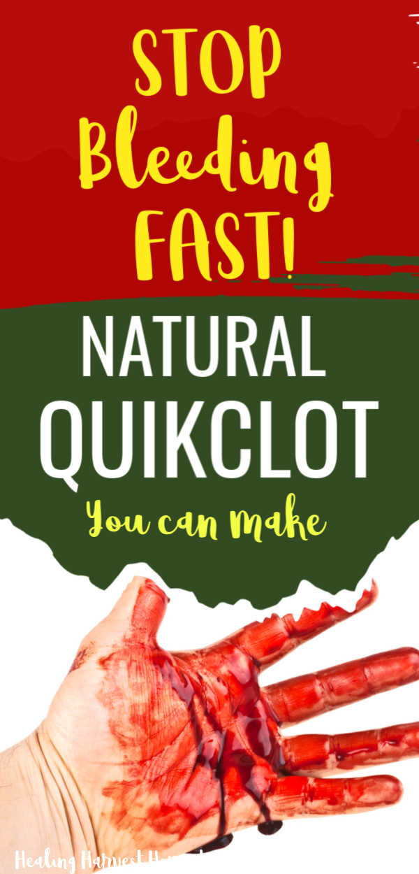 STOP Bleeding Fast in an Emergency---How to Make Your Own Natural ...