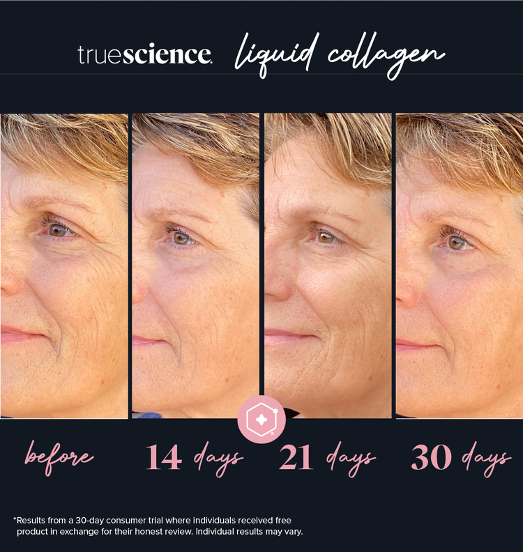 LifeVantage Introduces TrueScience Liquid Collagen to U.S. Market ...