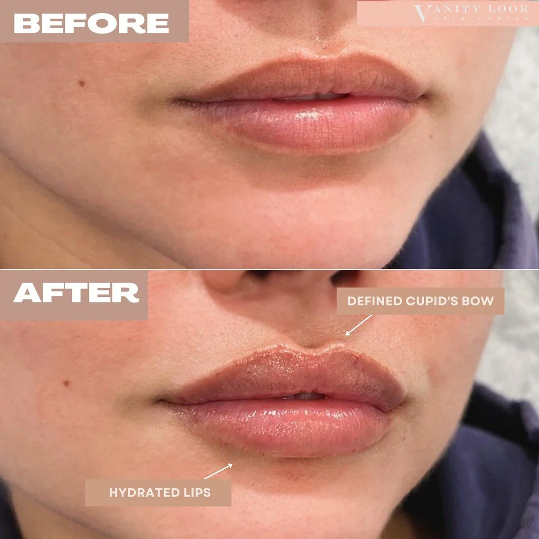 Vanity Look Skin Center