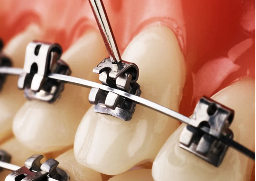 http://sdc.saveetha.com/news — dentistry @ saveetha