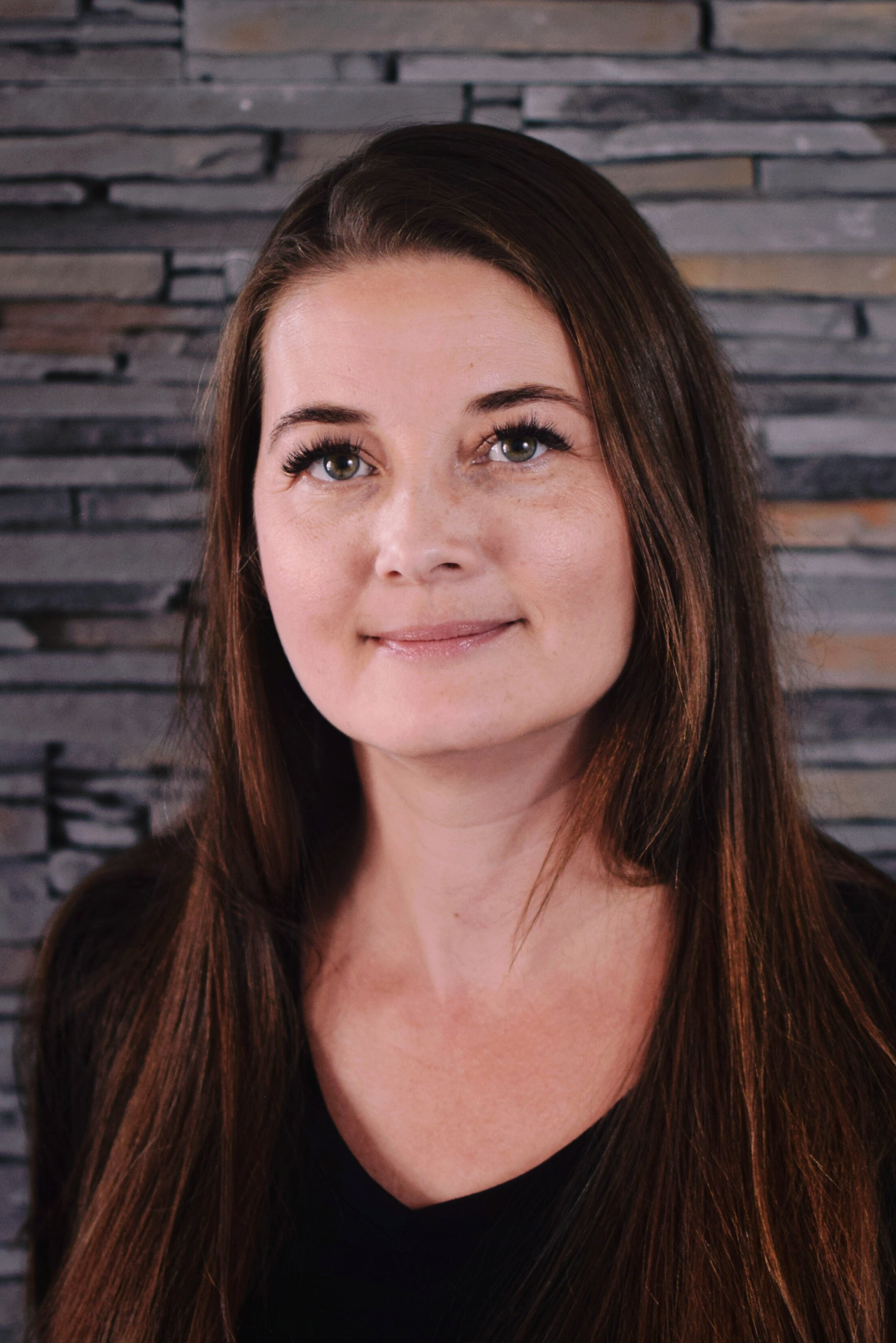 Cupping Therapy — True Touch Massage Therapy & Fitness