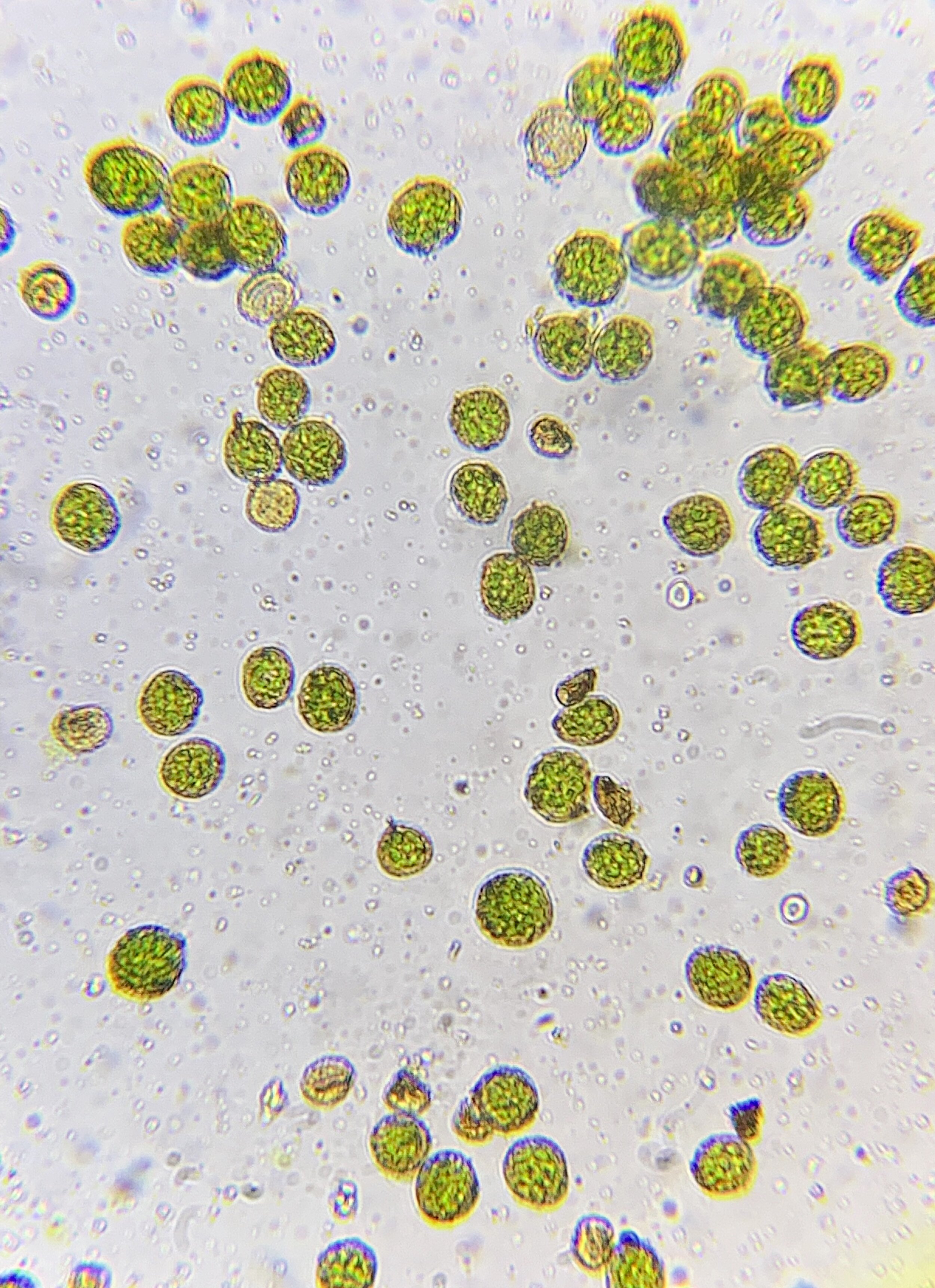 Moss Spores Microscope