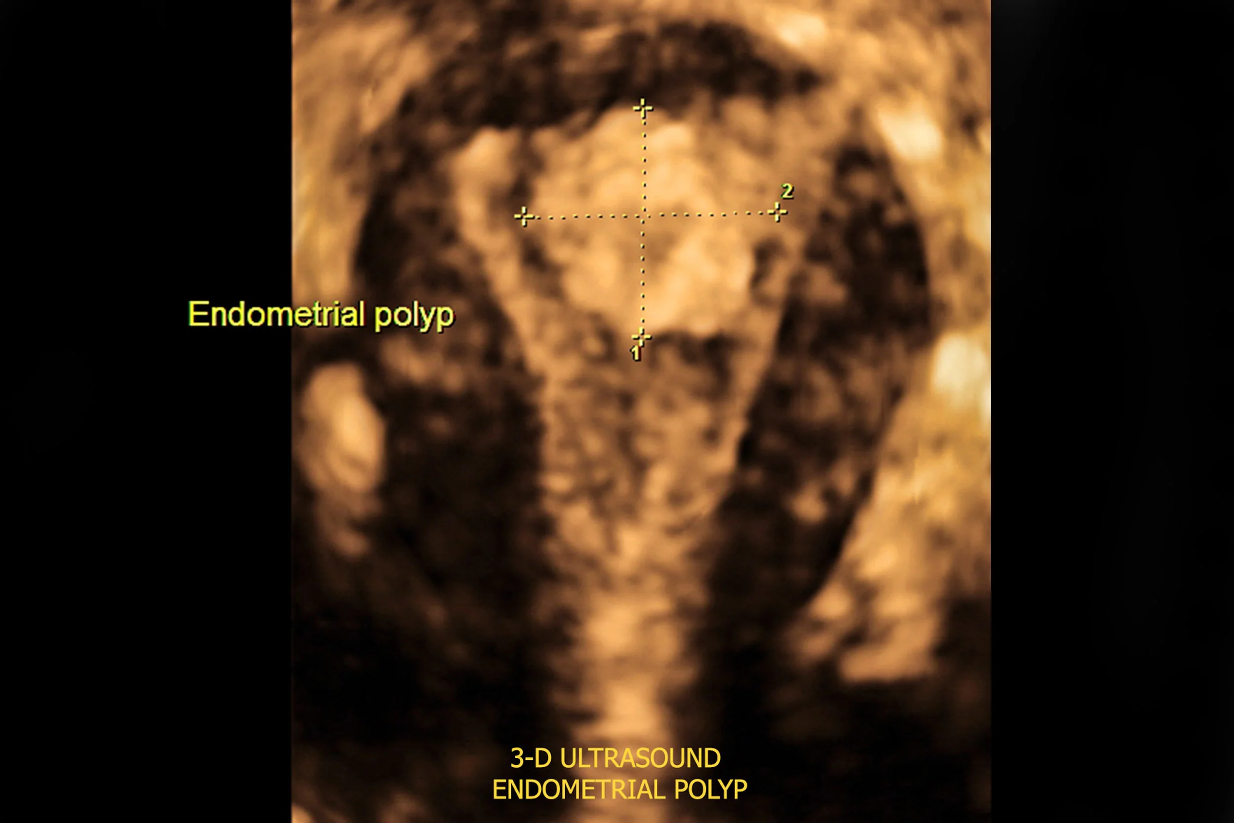 Τένοβα Ιορδάνα Γυναίκα Μαιευτήρας Γυναικολόγος Κοζάνη τεστ ΠΑΠ,3D ...