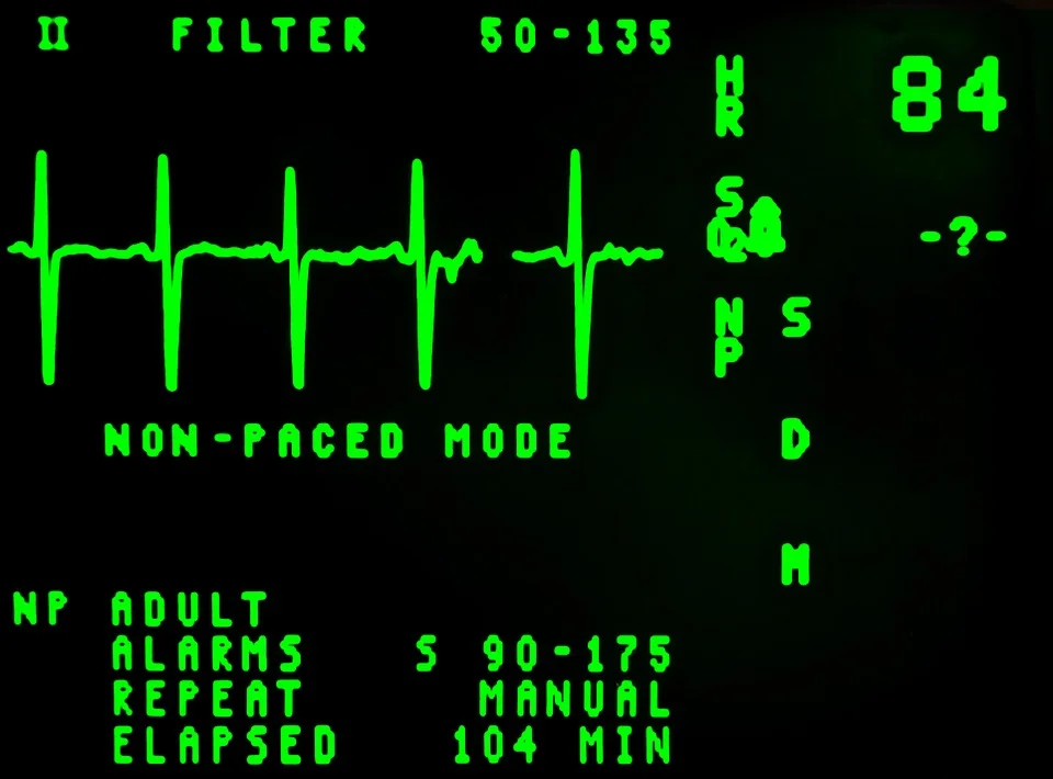 Transcutaneous Pacing — Downeast Emergency Medicine