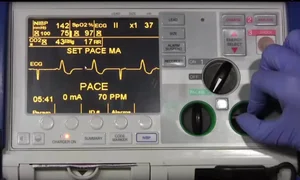 Transcutaneous Pacing — Downeast Emergency Medicine
