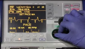 Transcutaneous Pacing — Downeast Emergency Medicine