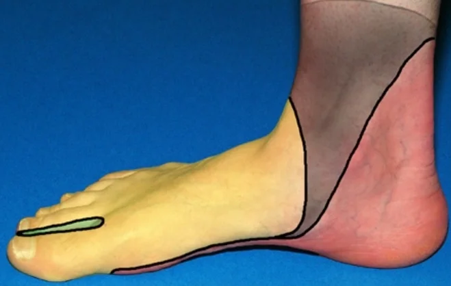 Regional Anesthesia — Downeast Emergency Medicine