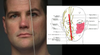 Nerve Blocks of the Face and Mouth — Downeast Emergency Medicine