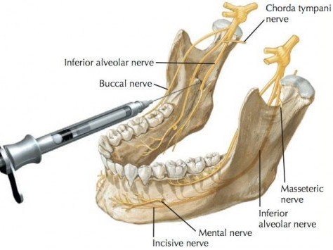 Nerve Blocks of the Face and Mouth — Downeast Emergency Medicine