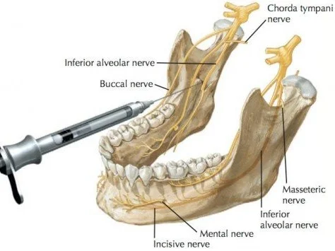 Nerve Blocks of the Face and Mouth — Downeast Emergency Medicine