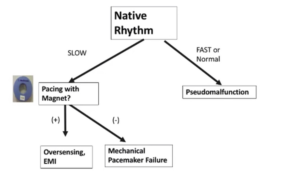 What the Heck is Going on with this Pacemaker?! — Downeast Emergency ...