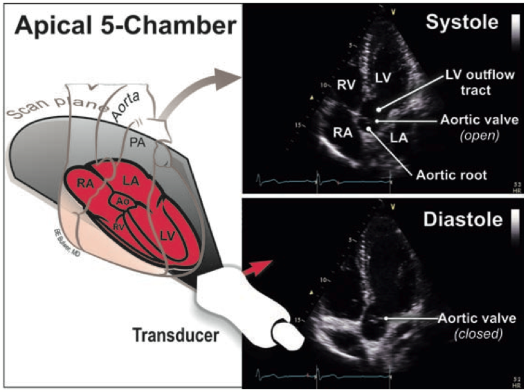 Velocity Time Integral (VTI) and the Passive Leg Raise: Taking Volume ...