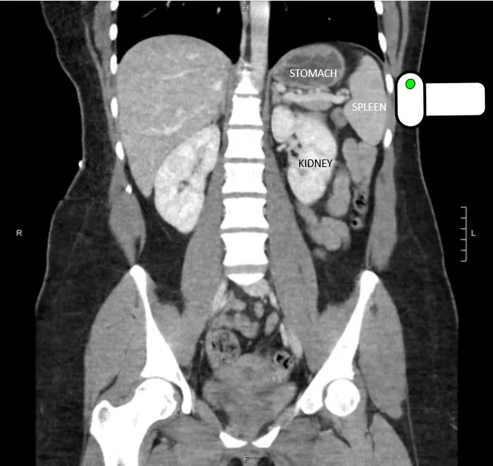 ARE YOU POSITIVE . . . OR FALSE POSITIVE? IMPROVING YOUR INTERPRETATION ...