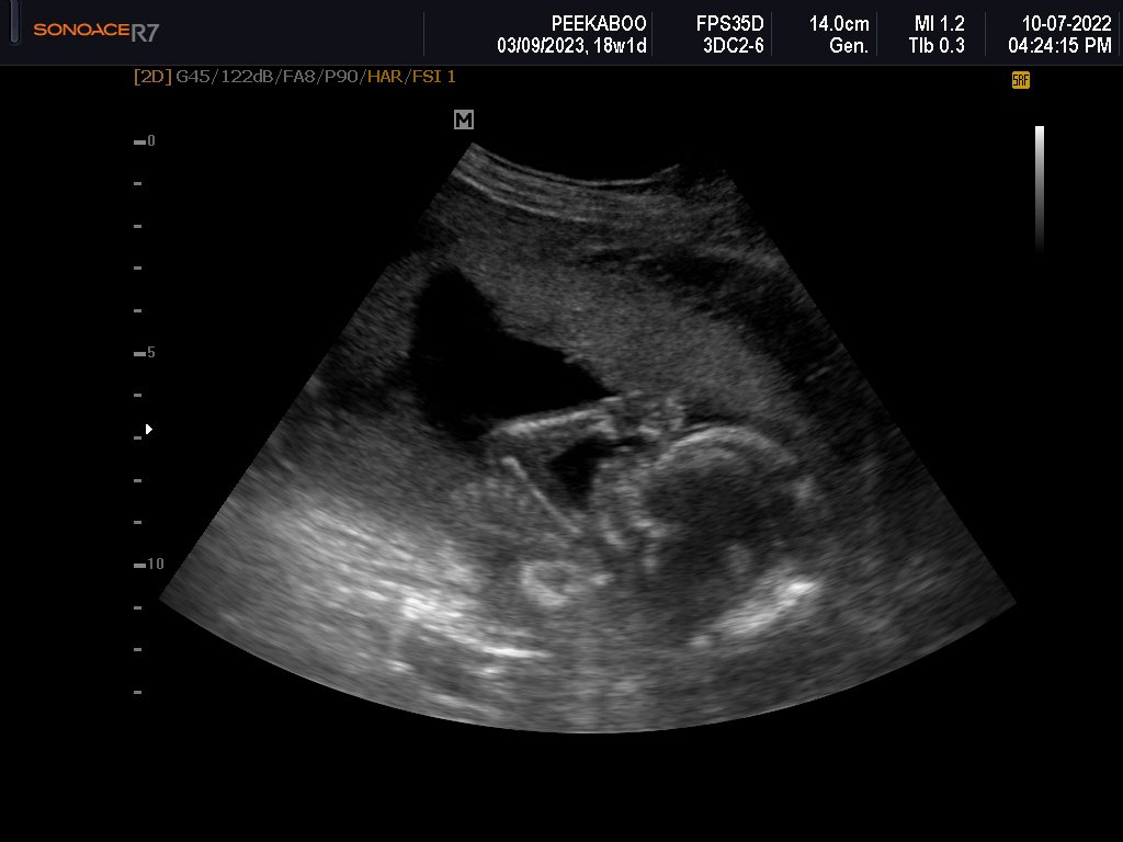 3D/4D Ultrasound Studio - Peekaboo Boutique - Athens, AL