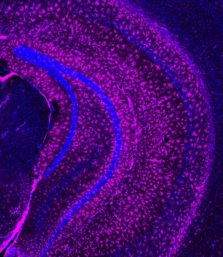 Current Projects — The Orr Laboratory