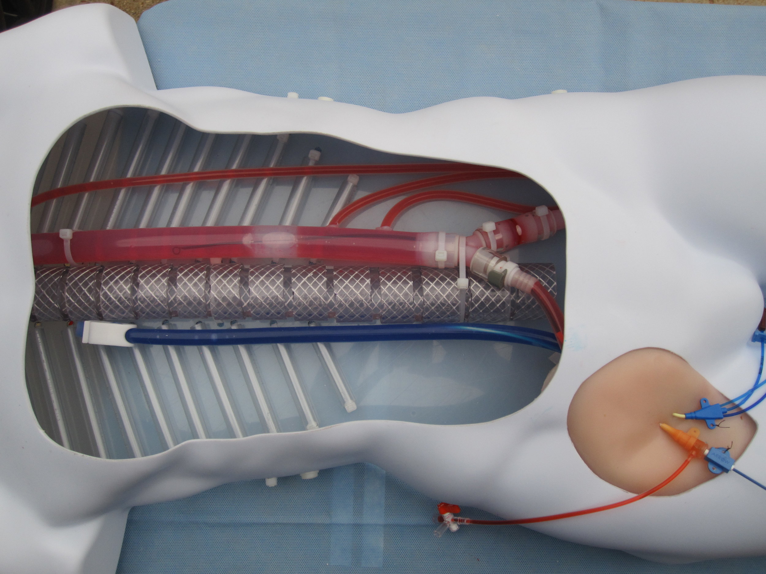 Mastering Hemorrhage Control Using REBOA – stbasiltroy