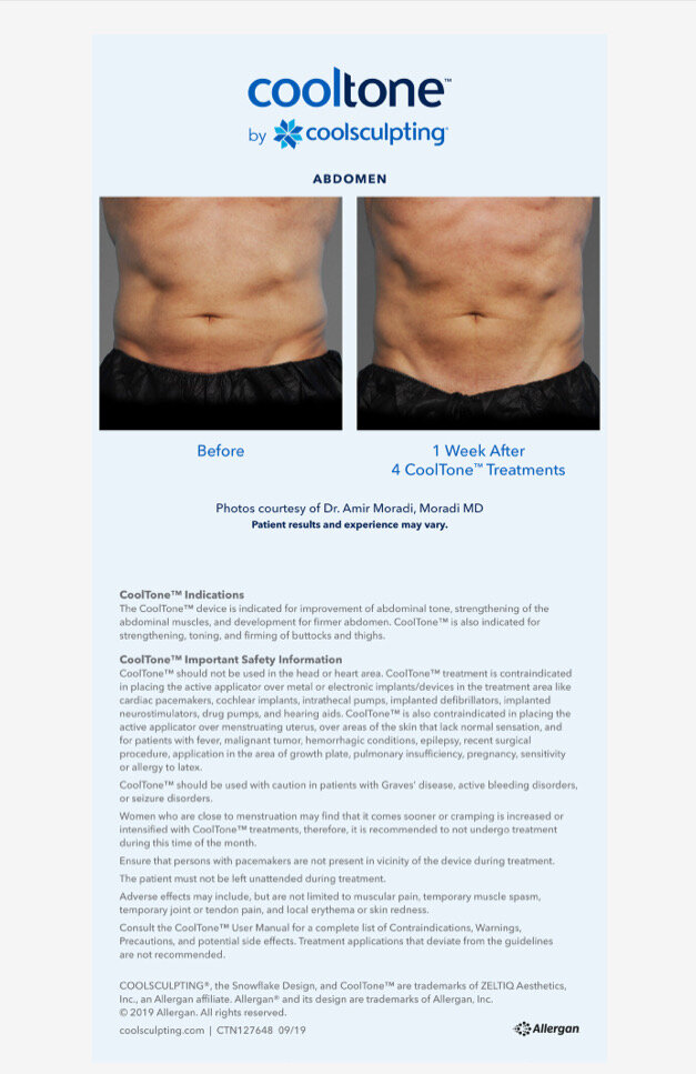 Body Contouring by Cooltone | Pure Luxe Medspa of Knoxville — Pure Luxe