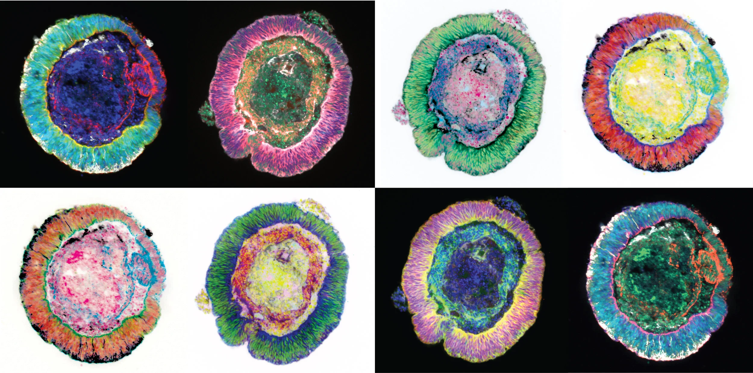 views from the scope