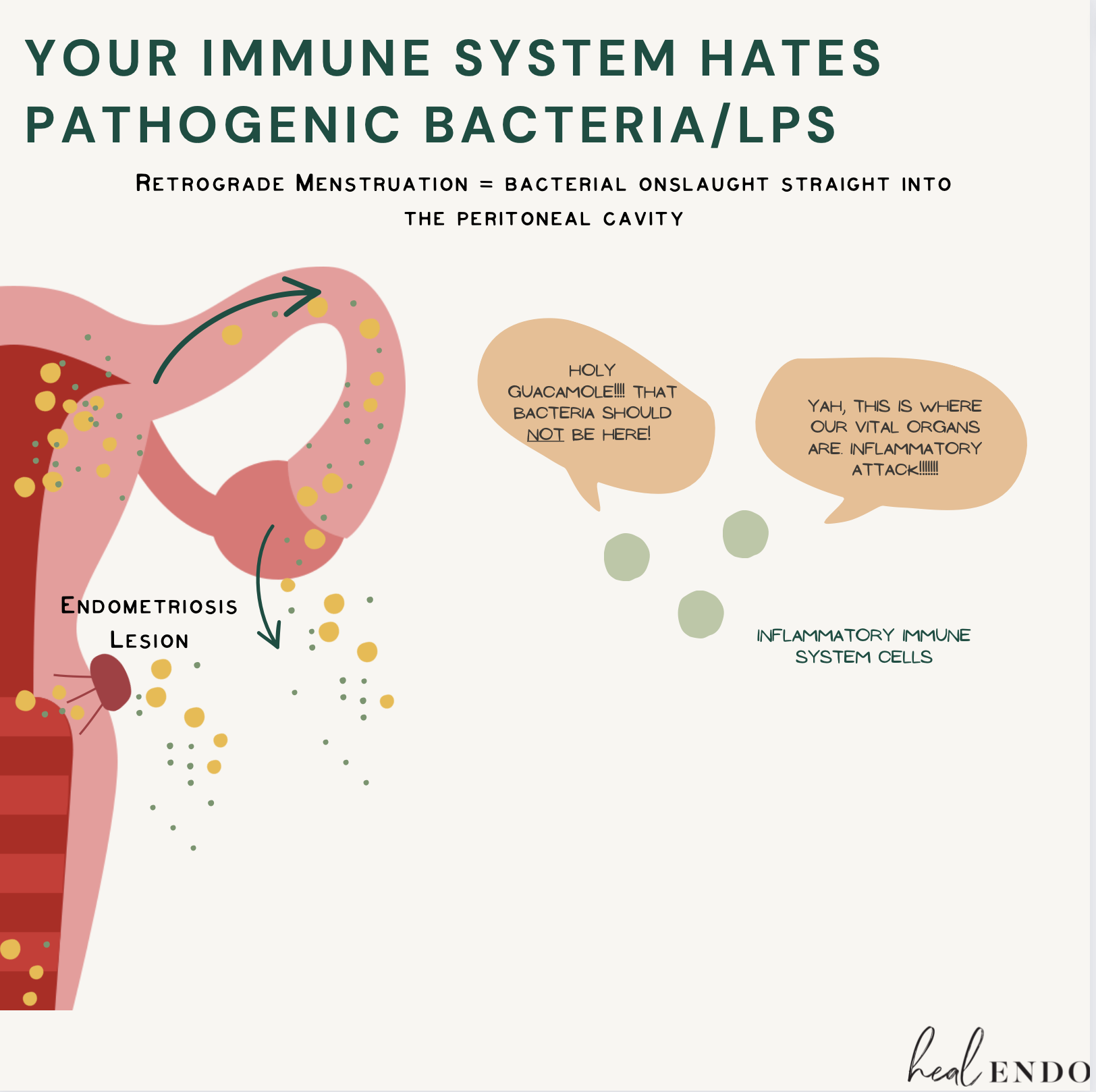 Endometriosis and Bacterial Imbalance — Heal Endo