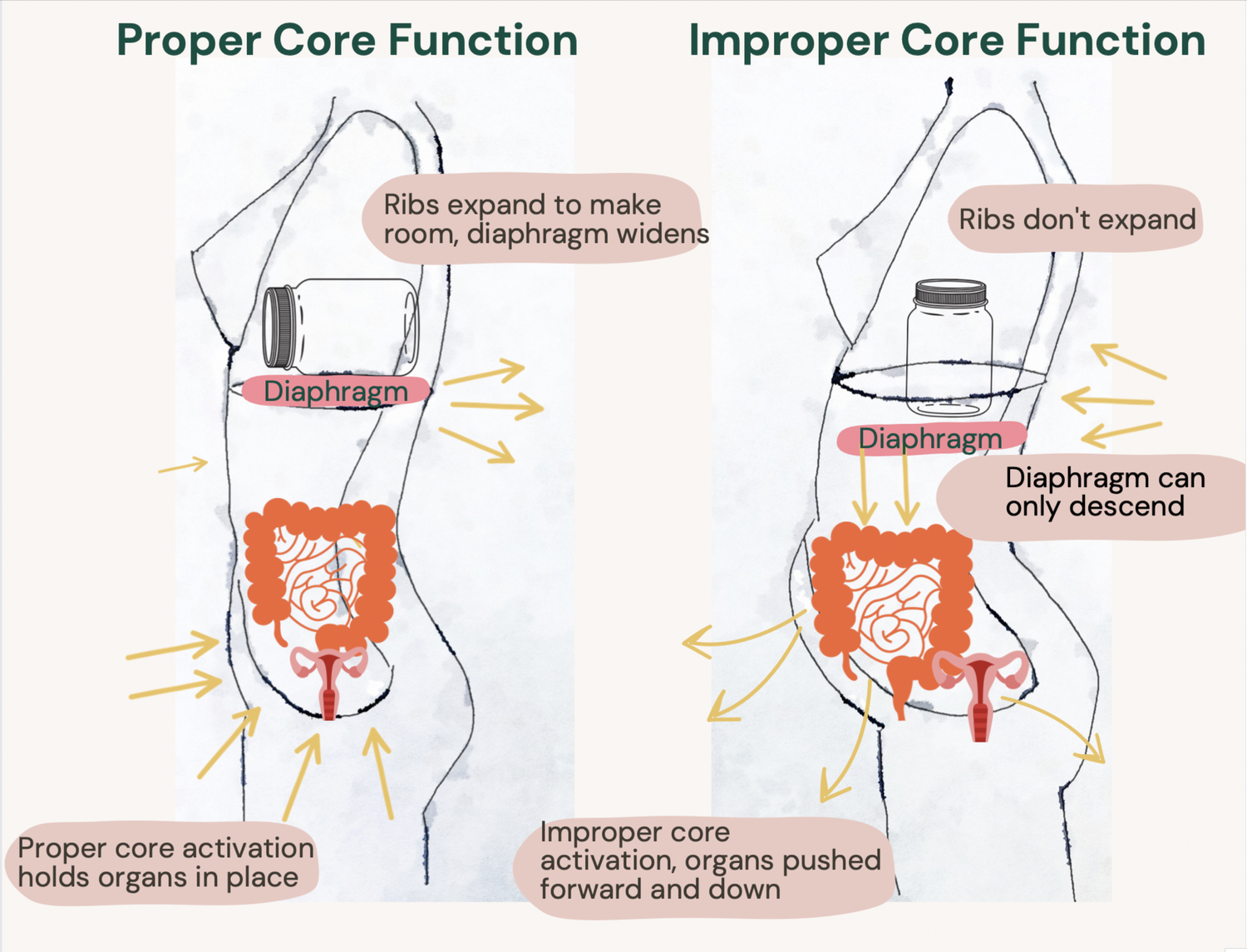 Pelvic Organ Prolapse, Endometriosis, and Kegel Exercises — Heal Endo