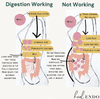 What is Endo Belly: Endometriosis Bloat, Digestive Disfunction — Heal Endo