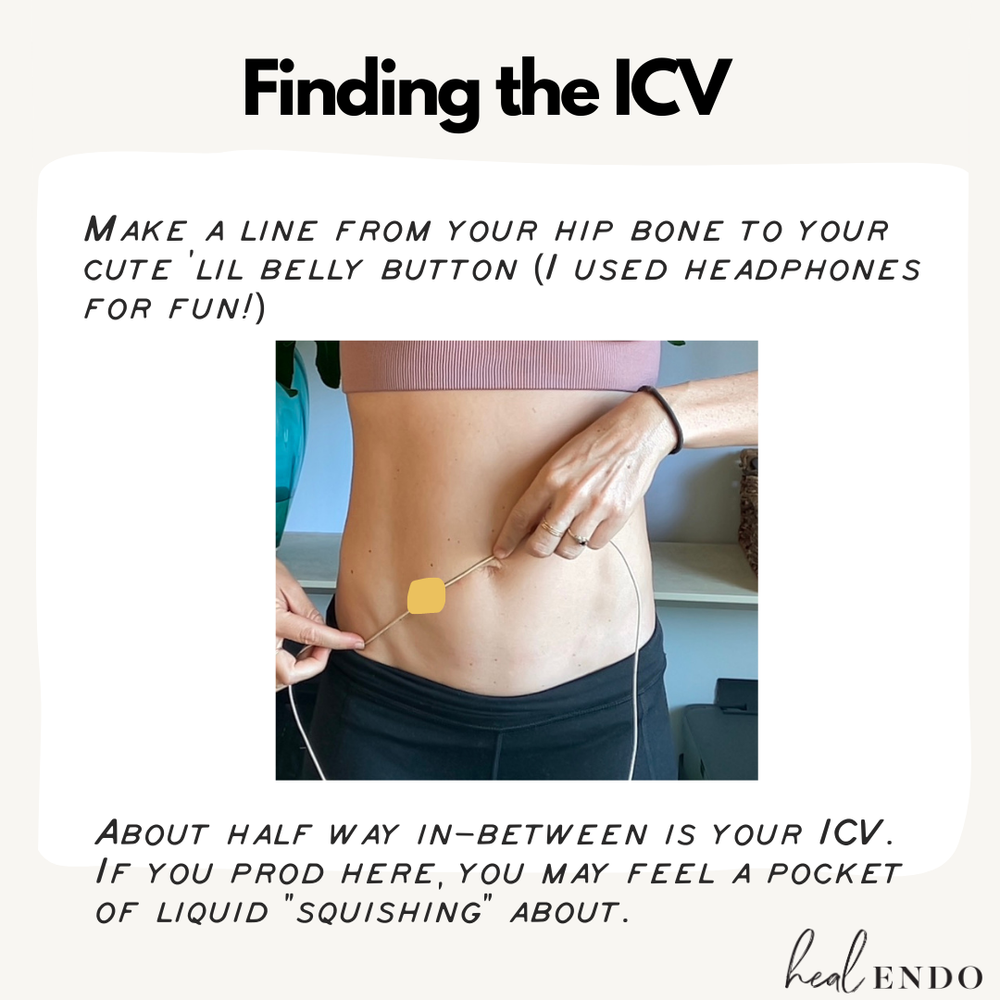 What is Endo Belly Series: Ileocecal valve pain — Heal Endo