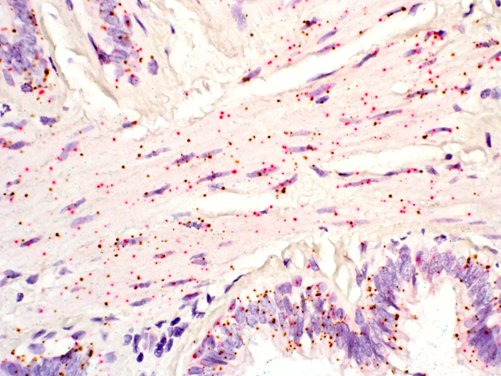 Paper analyzing splicing in the Tabula Sapiens dataset accepted at eLife — Salzman Lab