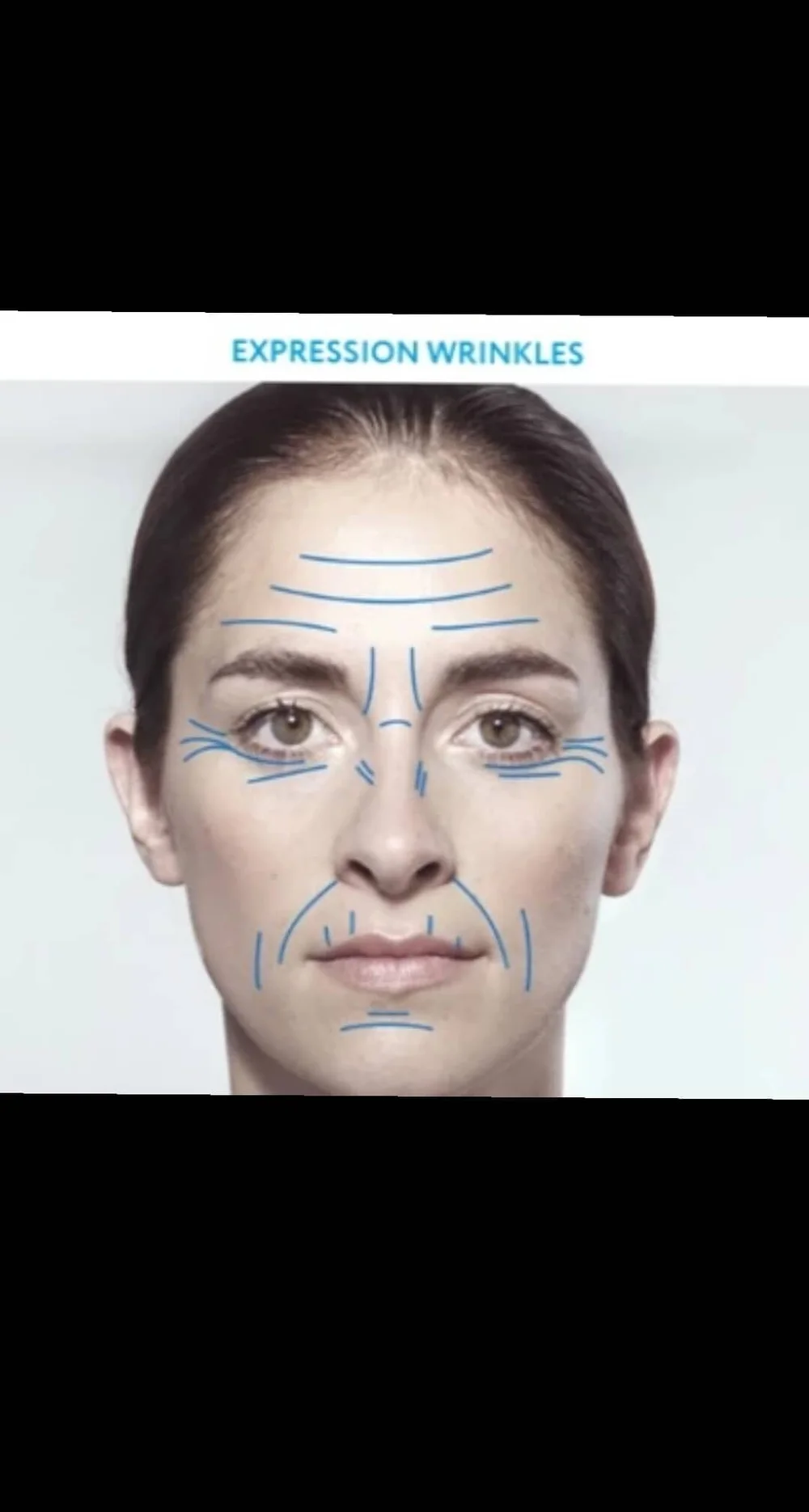Sleep Wrinkles | JUVERNE
