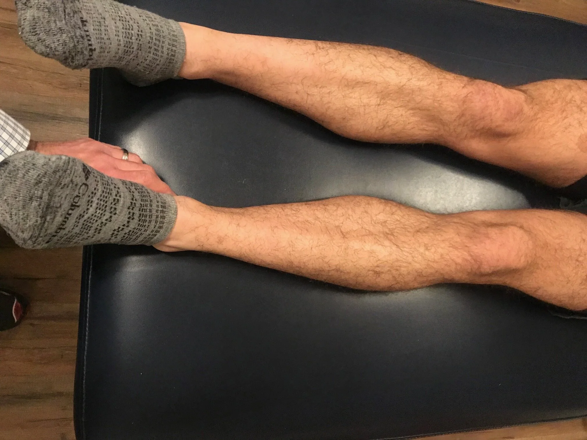 Internal tibial torsion puts pressure on the outside of the foot — The ...