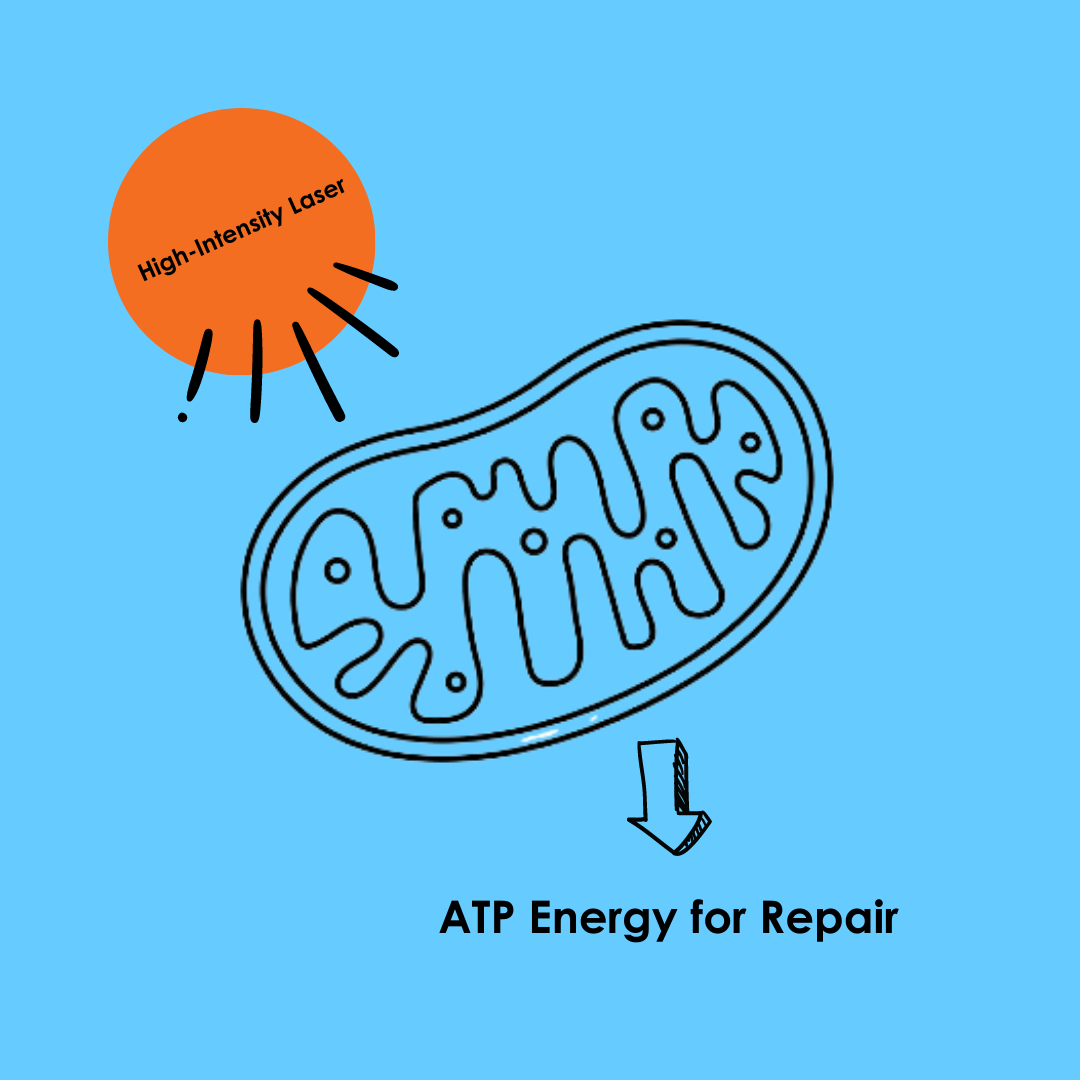 The Science Behind High-Intensity Laser Therapy (HILT) — CoachAmyPT