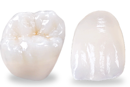 Epic Dental Lab-Indiscernible Dentistry