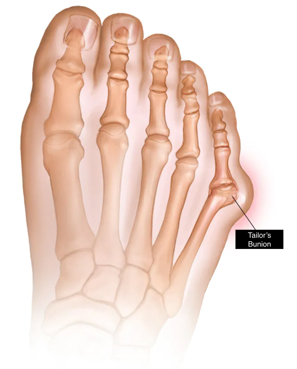 Read Our Latest Blog Posts - Chelsea Foot and Ankle
