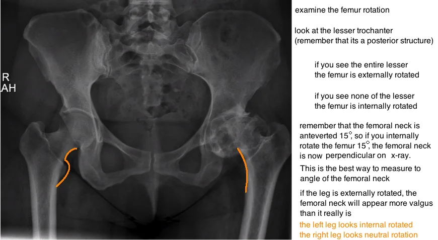 PRE-OP EVALUATION — Hip & Knee Book