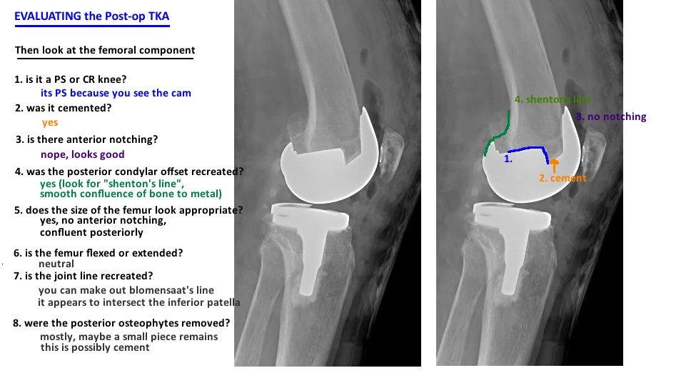POST OP EVALUATION Hip Knee Book