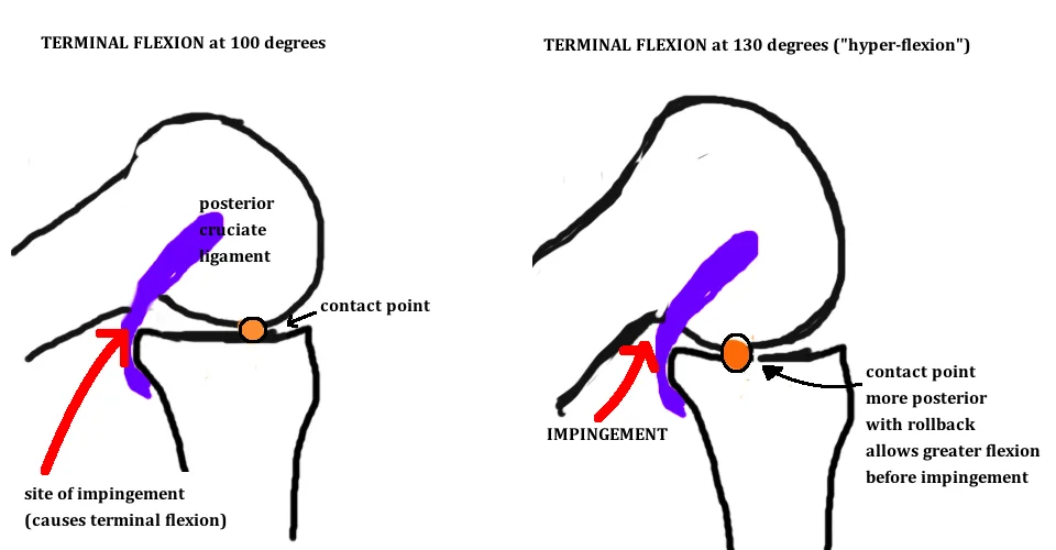 NATIVE KNEE KINEMATICS Hip Knee Book