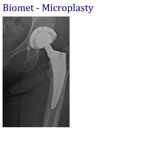 IMPLANT ATLAS — Hip & Knee Book