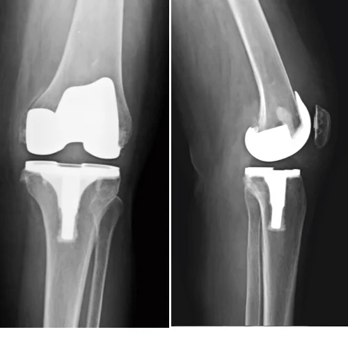 KNEE SYSTEMS ATLAS — Hip & Knee Book