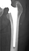 IMPLANT ATLAS — Hip & Knee Book