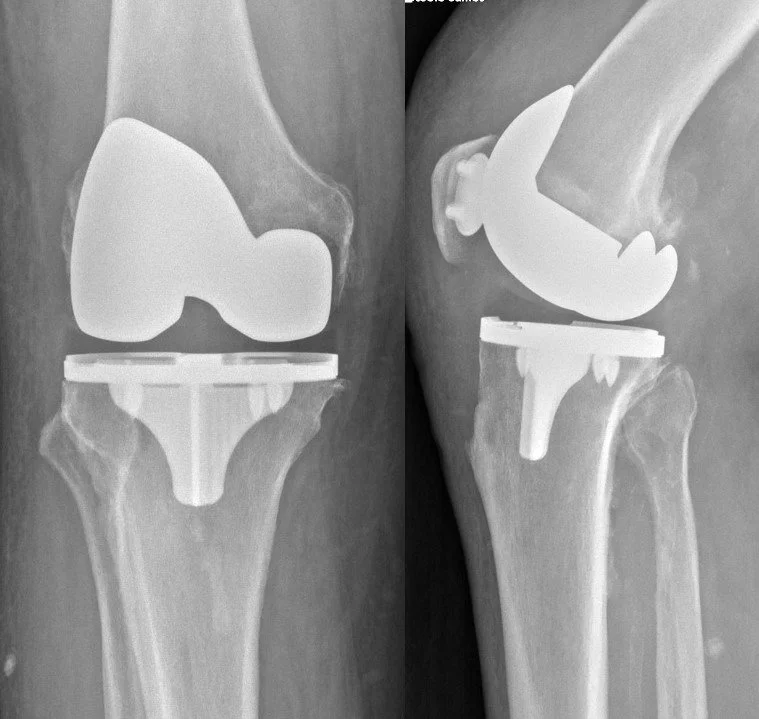 KNEE SYSTEMS ATLAS — Hip & Knee Book