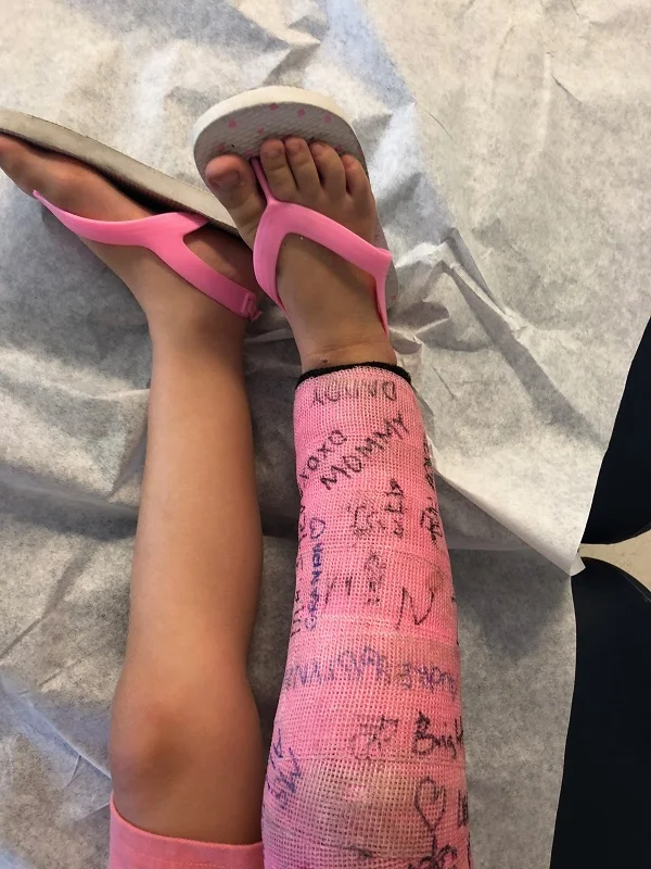 A Parent's Survival Guide to Having a Kid in a Full Leg Cast — Veggies ...