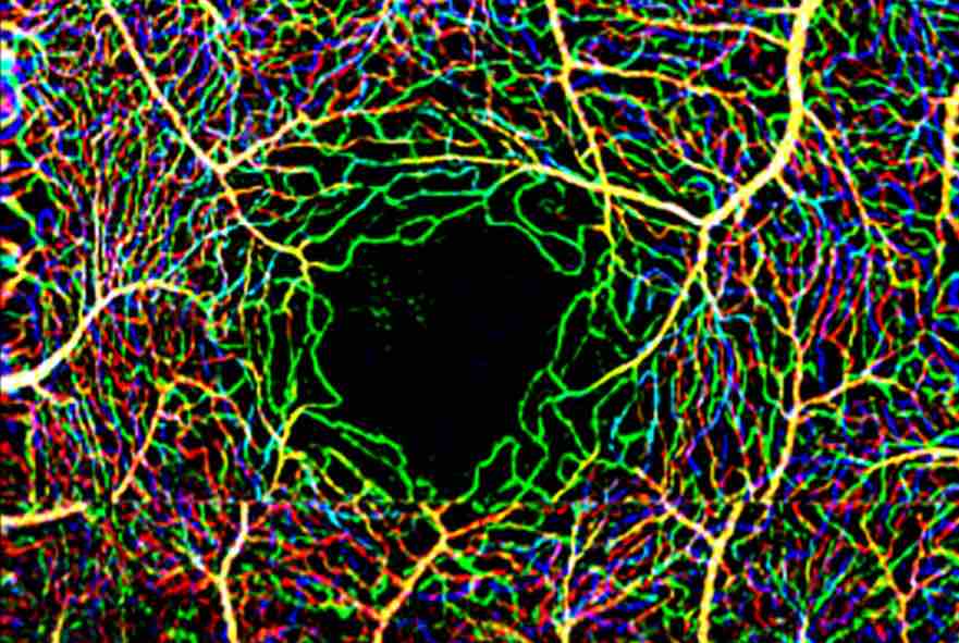 Peter A. Karth, MD, MBA, FASRS, FACS: Orgon's Retina Specialist