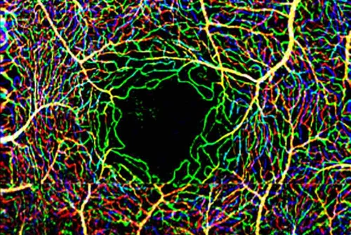 Peter A. Karth, MD, MBA, FASRS, FACS: Orgon's Retina Specialist