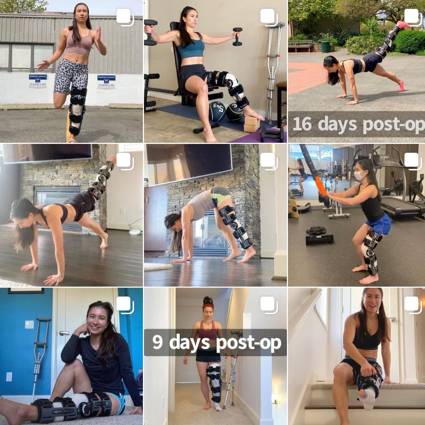 ACL Graft: Bone-Patellar Tendon-Bone or "BTB" — Christopher J. Wahl, MD ...