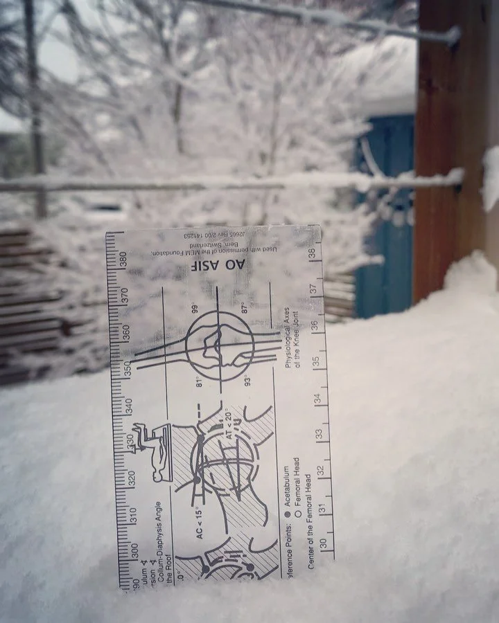 Cartilage Grading : Outerbridge Scale — Christopher J. Wahl, MD ...