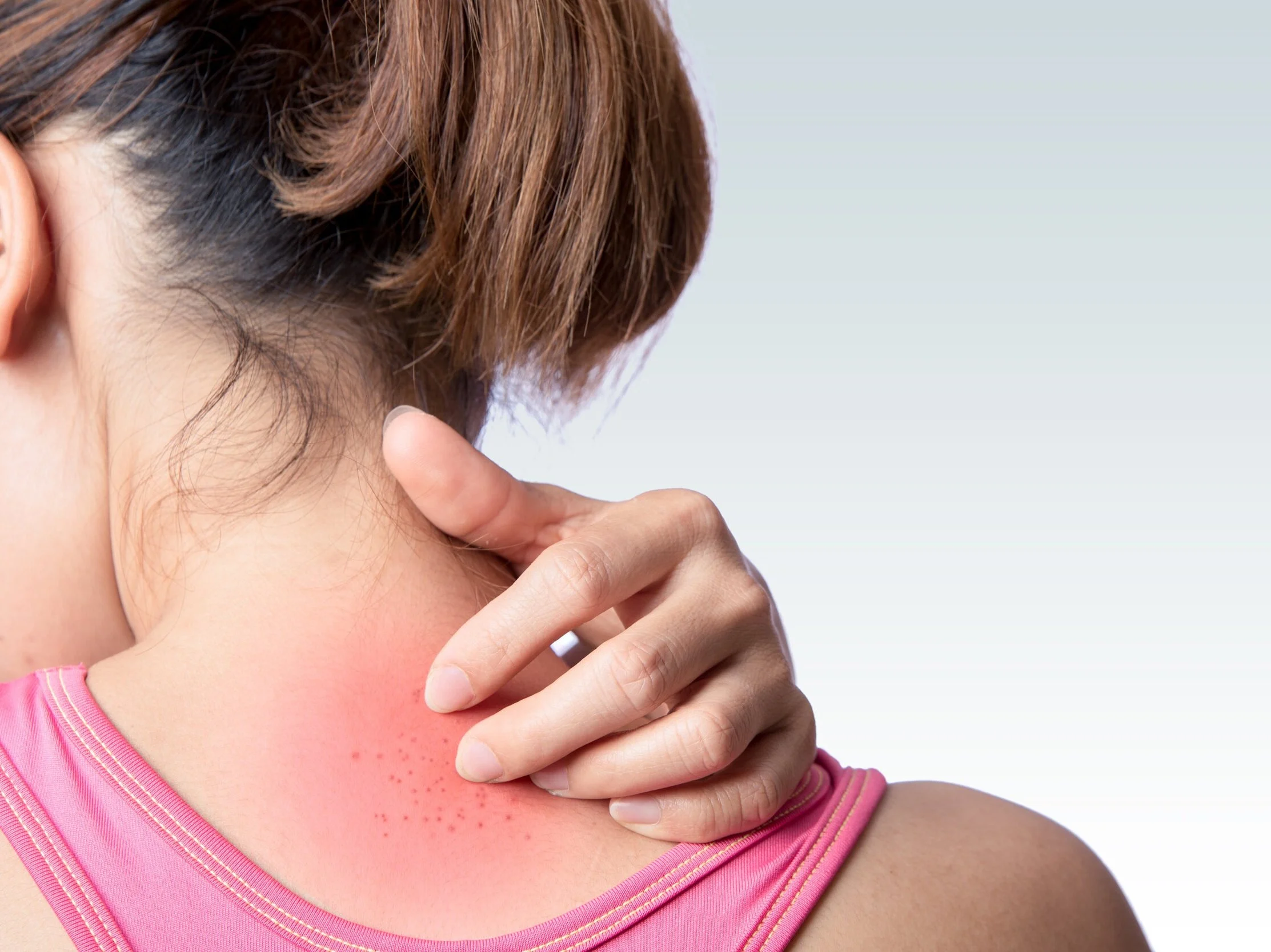 EndIt! Topical Ointment