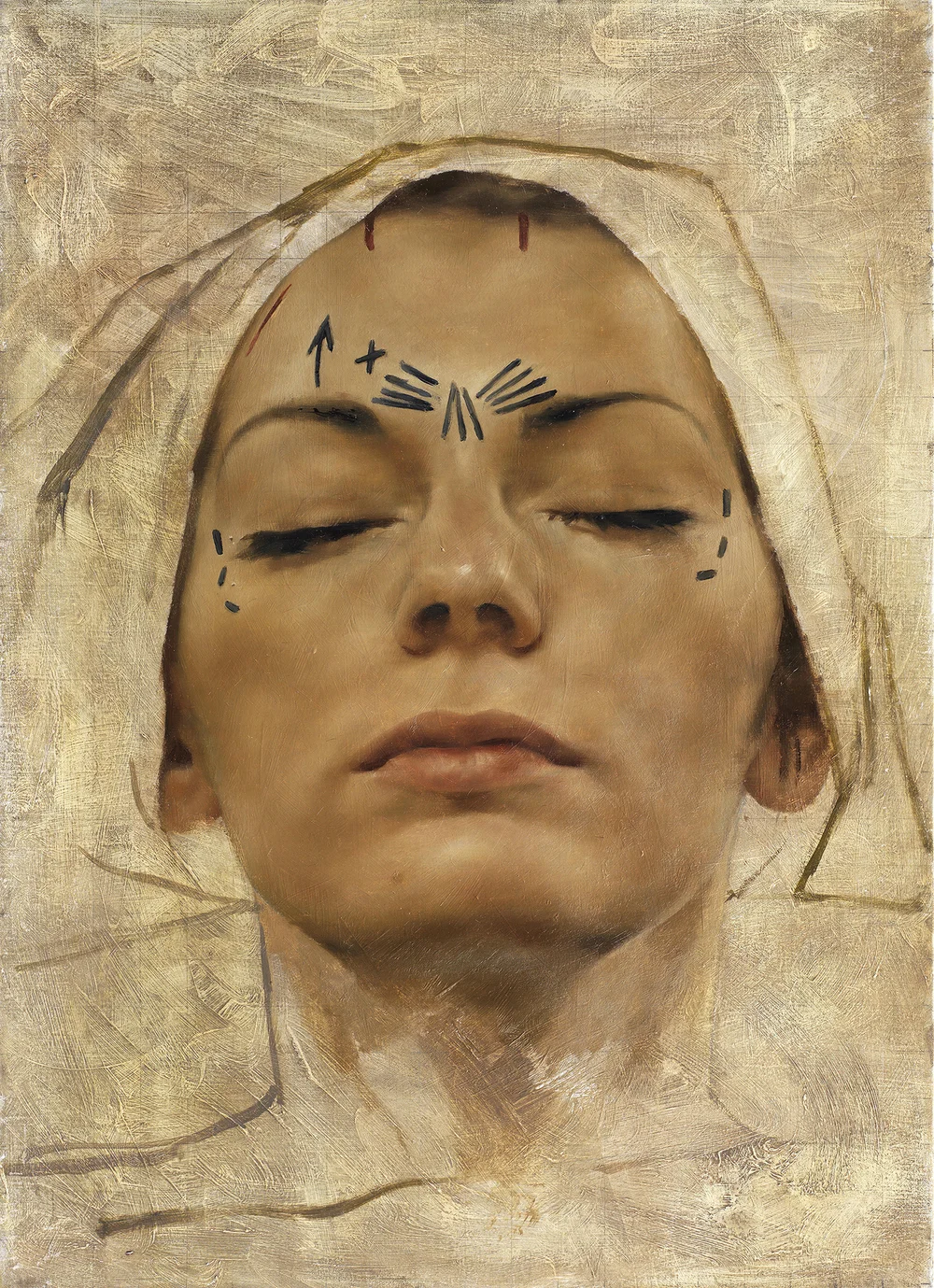 Jonathan Yeo — Endobrow Lift II