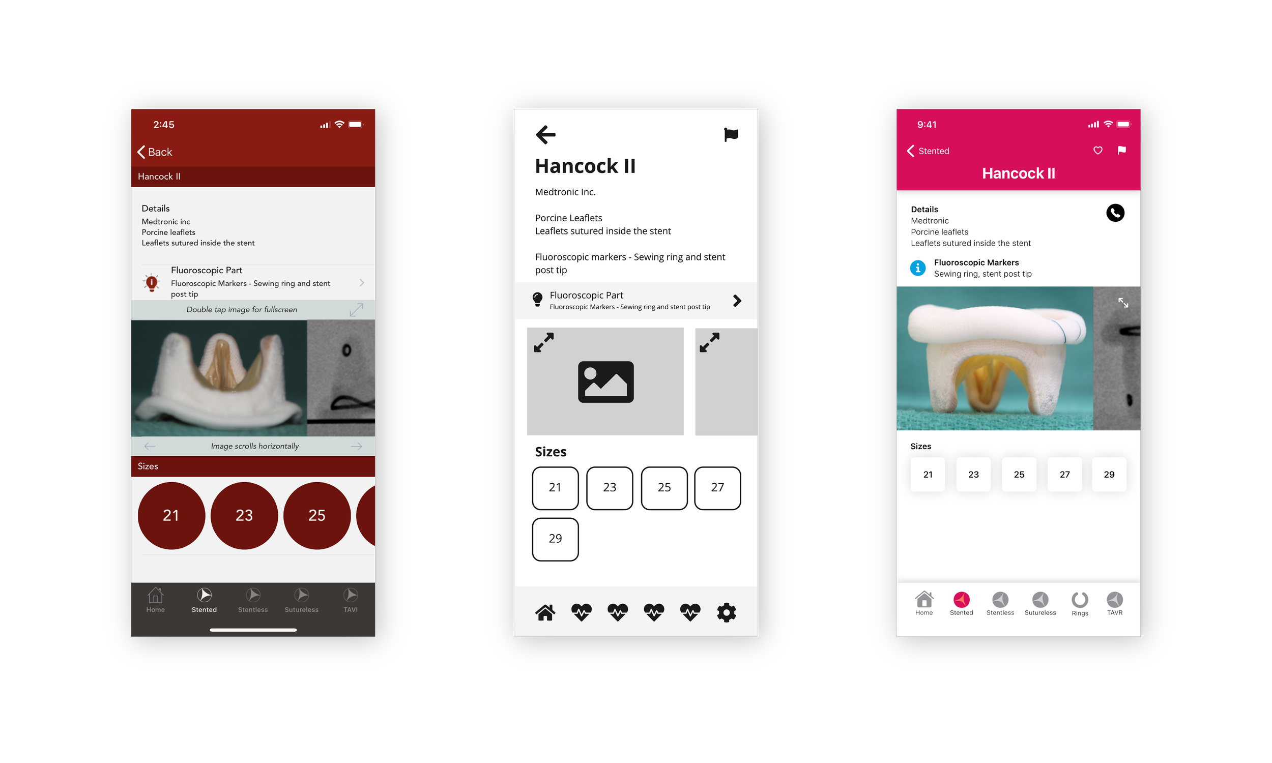 MHIF ViV Case Study — KRUTSCH Design