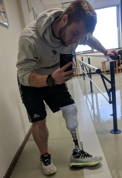 How is a Below-Knee Prosthetic Leg Attached? — Jamie Gane