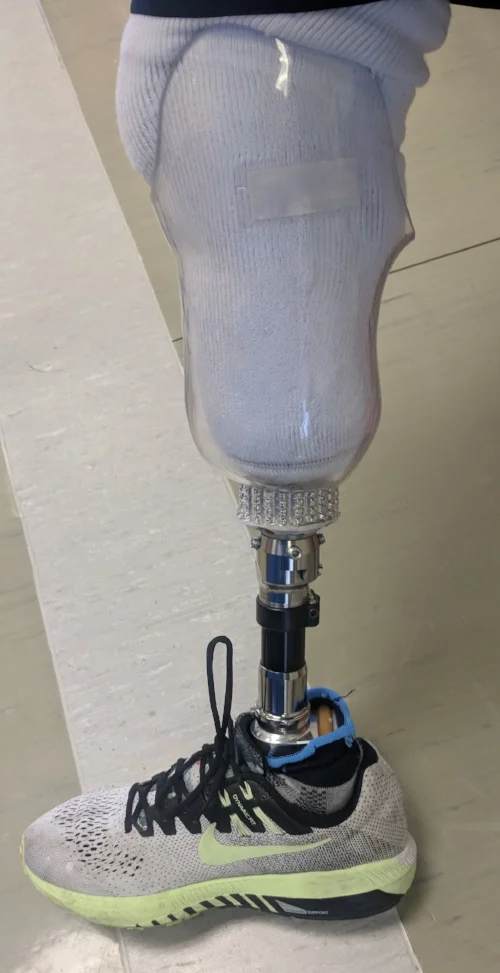 How is a Below-Knee Prosthetic Leg Attached? — Jamie Gane
